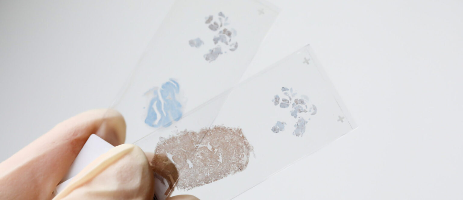 Liquid vs. Solid Biopsy – Omega Bio-tek