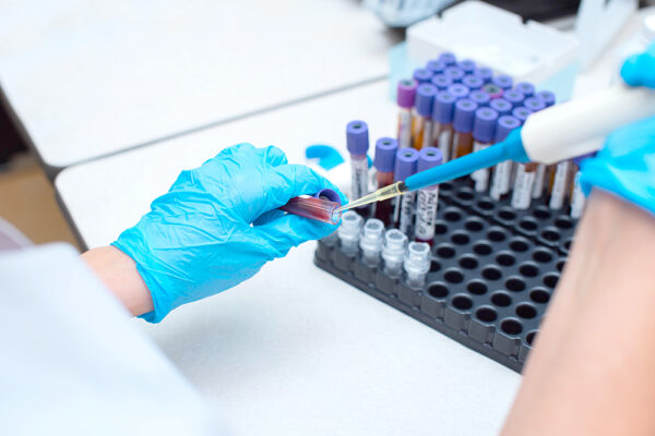 Prenatal Testing – Omega Bio-tek